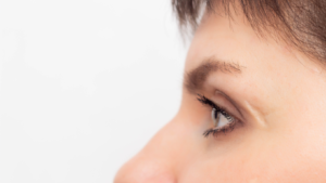 Cicatrices sur le visage : comment les estomper ? - Ma Cicatrice